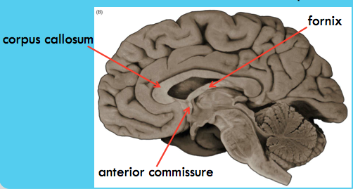 Intro Mind and Brain - Topic 2 - Foundation - Brains Flashcards by ProProfs