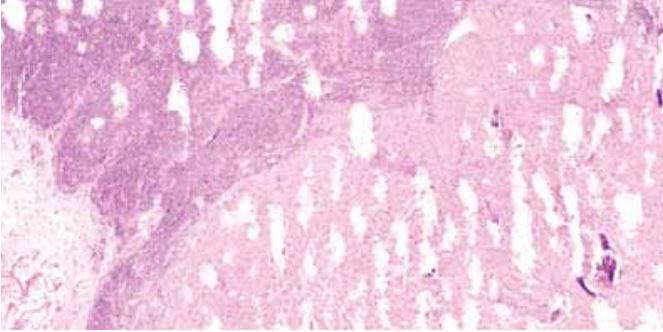 Microtomy Sectioning Troubleshoot Flashcards by ProProfs